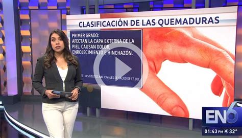 Video Tipos De Quemaduras