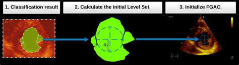 Flowchart For Detection Of The Initial Level Set An Initial Contour Download Scientific