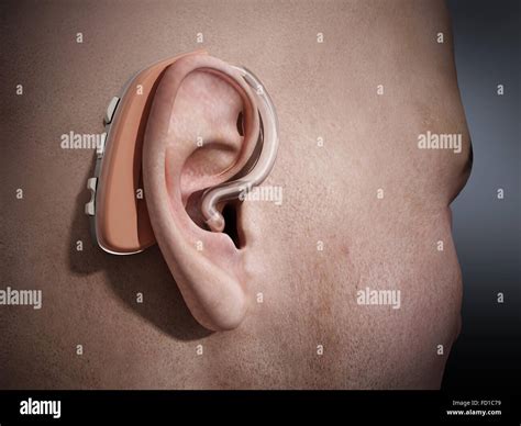 Hearing Aid Hi Res Stock Photography And Images Alamy