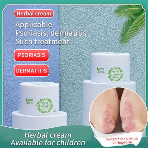 Zudaifu 피부 건선 크림 피부염 습진 연고 습진 치료 건선 크림 소매 상자 포함 Aliexpress
