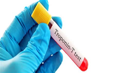 Kalp Ve Iskelet Kaslarında Farklı Tipte Troponin Bulunur Kalp