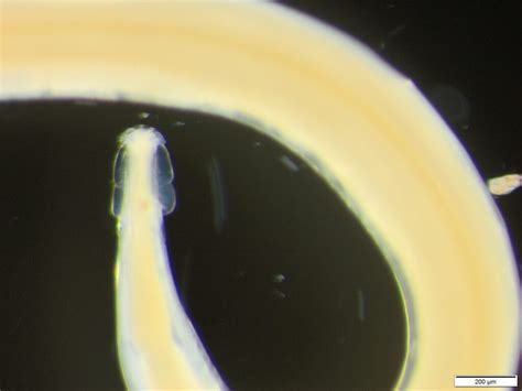 Nodule Worm And Large Bowel Worm In Cattle Wormboss