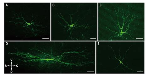 Preparation Of Acute Spinal Cord Slices For Whole Cell Patch Clamp Recording In Substantia