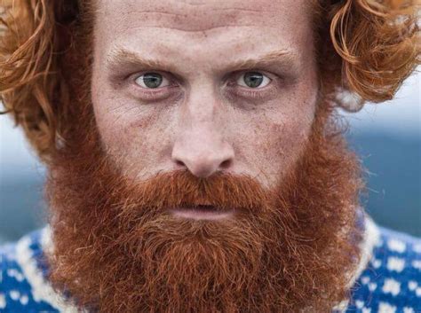 Are We In Danger Of Losing Blue Eyed Redheads Not Likely Genetic
