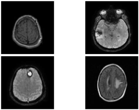 Algorithms Free Full Text A Comprehensive Brain Mri Image