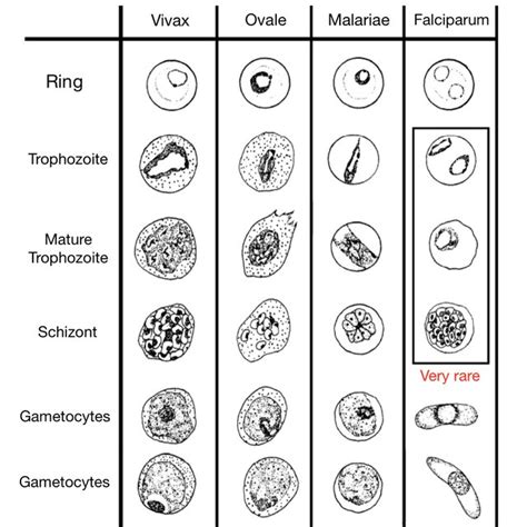 Examples Of Malaria Parasite Stages From Top Left Pfalciparum Ring
