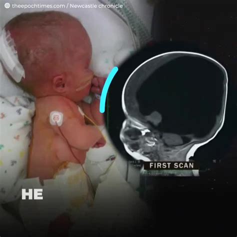 Jeanee Rose Andrewartha On Linkedin Defying The Odds 💪 Noah Wall Was Born With Just 2 Of His