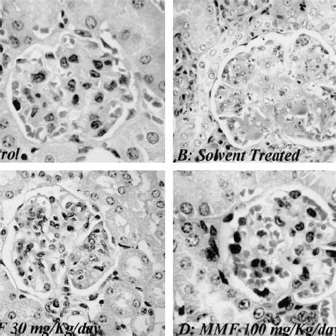 Representative Histological Appearance Of Glomeruli From Month Old Download Scientific
