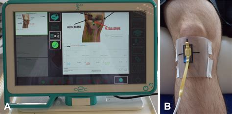 A Hardware For Microcirculation Measurement Using A Laser Doppler