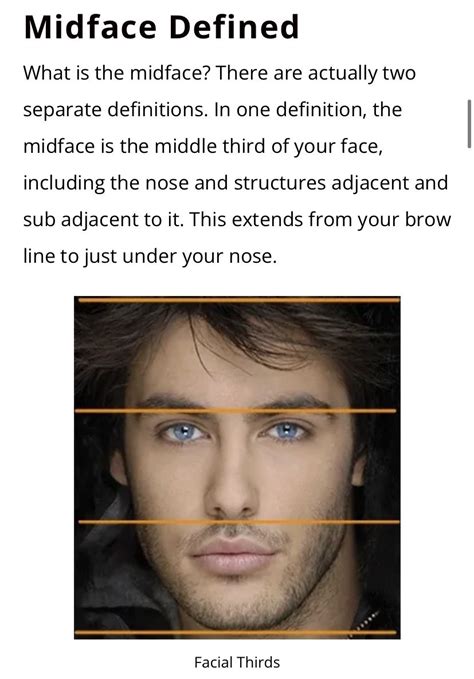 Midface Defined Facial Fillers Facial Bones Facial