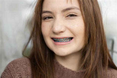 Why Braces Are More Than Just A Cosmetic Treatment The Coffee Mom
