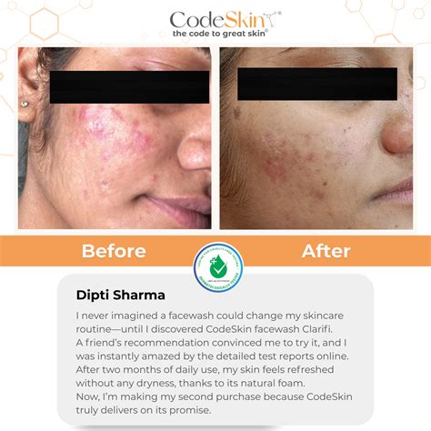 When Was Sunscreen Invented History And Invention Codeskin