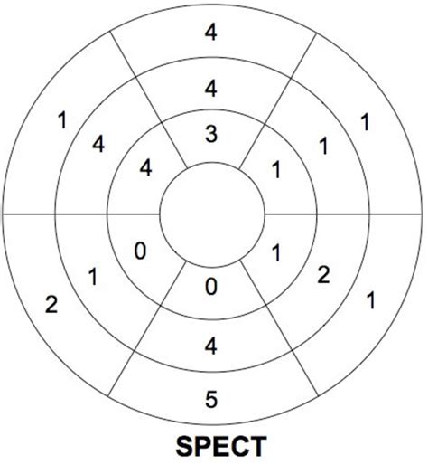 Localisation And Total Number Of Reversible Perfusion Defect Segments Download Scientific