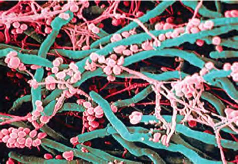 Colored Scanning Electron Micrograph Of Dental Plaque Streptococcus
