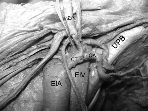 Dissection Of A Left Hemipelvis Anterior View The Common Trunk Download Scientific Diagram
