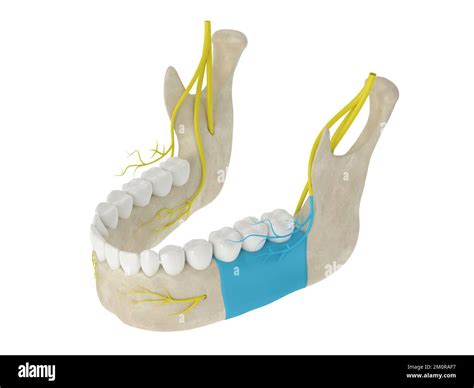Dental Anesthesia Nerve Block At Terry Haskell Blog