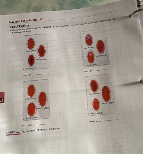 Solved Post Lab Assessment 19c Blood Typing 1 Complete The
