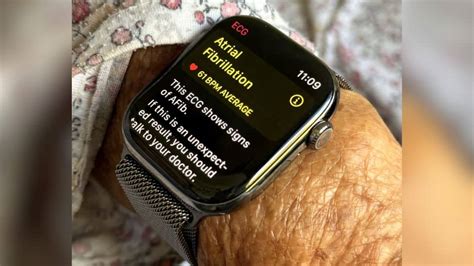 Apple Watch Series 10 Saves Elderly Woman By Detecting Irregular Heartbeat Netizens React To