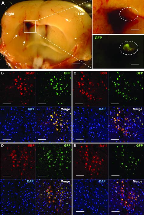 Implanted Hap Stem Cells Repair The Ich Site In Nude Mice A Download Scientific Diagram