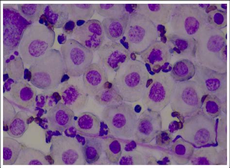 100 Parabasal Cells With Numerous Neutrophils During Diestrus 100x