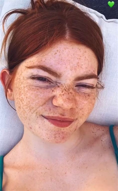 Freckles Tache De Rousseur Rousseur Femme