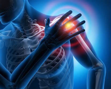 Hip Impingement Cam And Pincer Lesions Causes And Symptoms