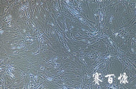 小鼠原代主动脉平滑肌细胞 原代细胞 Str细胞 细胞培养基 镜像绮点生物
