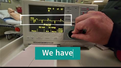 tcp transcutaneous pacing youtube