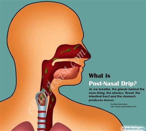 Nasal Drip Symptoms Factory Sale