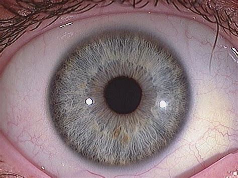 15 Best Iris Patterns Iridology Images On Pinterest Irise Irises And Lilies