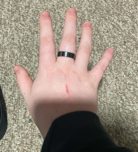 Finally Got My Ace Ring Feel Soo Happy 😆 R Aaaaaaacccccccce