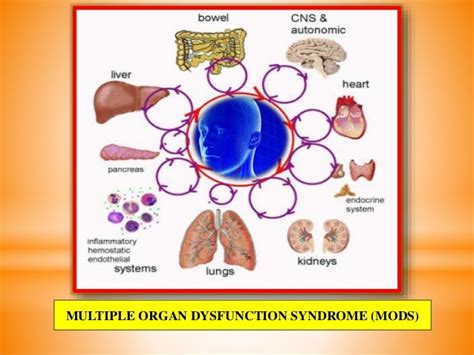 Multiple Organ Dysfunction Syndrome Mods