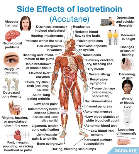 What Is Pyoderma Faciale