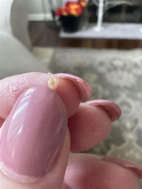 Is This A Bed Bug Casing Rbedbugs Is This A Bed Bug Casing Rbedbugs