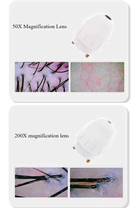 All In One Scalp Hair Analyzer Device High Definition Skin And Hair Detector 10 Inch Display