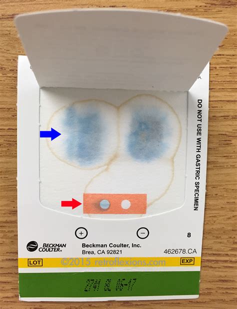 Blood In The Stool Test Fecal Occult Blood Test Purpose Procedure