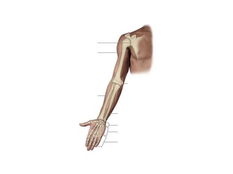 Fracture Coding Cm And Pcs Pptx Death Injury Or Military Conflict Fracture Coding Cm And Pcs Pptx Death Injury Or Military Conflict