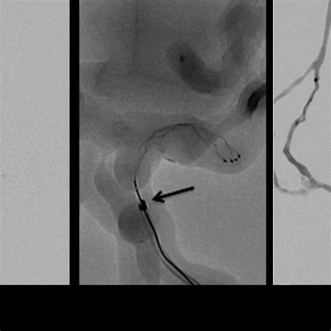 New 3d Printed Cardiac Phantom Left Picture Shows A Phantom Of A Download Scientific Diagram