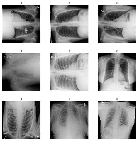 Using The Fastai Data Block Api The New Fastai Library Has Made The By Tom Mckenzie Medium