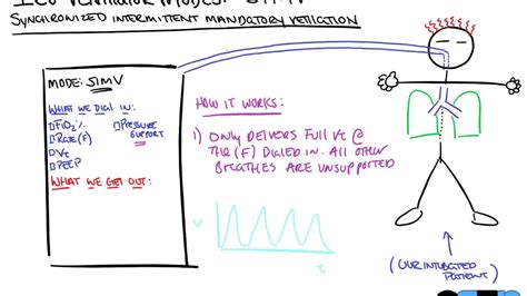 Simv En Ventilador Qué Es Cómo Funciona Y Cuándo Se Utiliza La Casa Del Ventilador