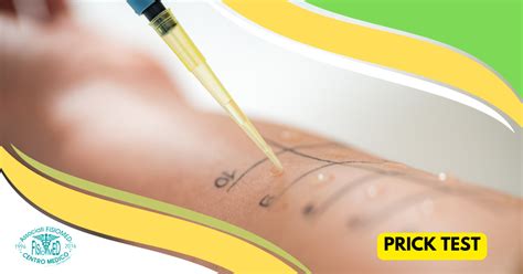 Prick Test Per Allergie A Civitanova Porto Santelpidio Fisiomed