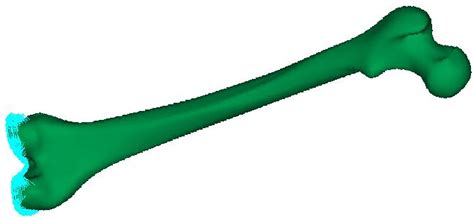 Figure 5 From Finite Element Analysis Of Ct Based Femur Model Using