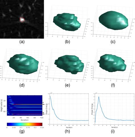 Figure 1 From Segmentation And Classification Of Lung Nodules From Thoracic Ct Scans Methods