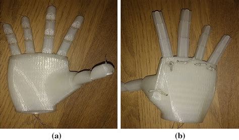 a b three dimensional printed model of prosthetic arm download