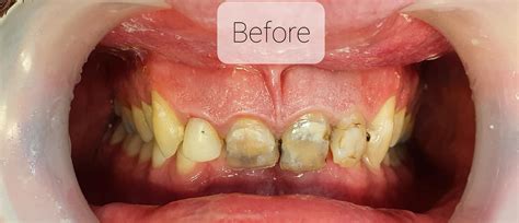 Some Before And After Photos For A Dr Nicholas Moran Facebook