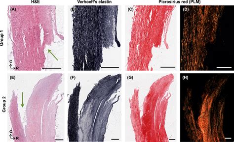 Representative Histology Of Strips In A D Group 1 And E H 2 Hande