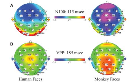 Topographic Head Plots Using A Spherical Spline Interpolation Of The