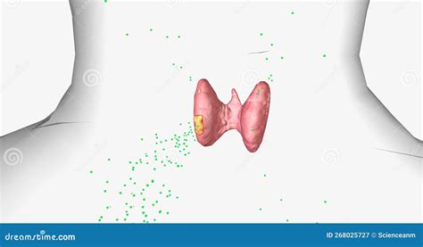 Due To Their Increased Number Of Cells Enlarged Parathyroid Glands