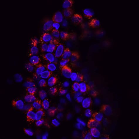 Workshop Spatial Multi Omics For Mapping Human Tissue Function Aging