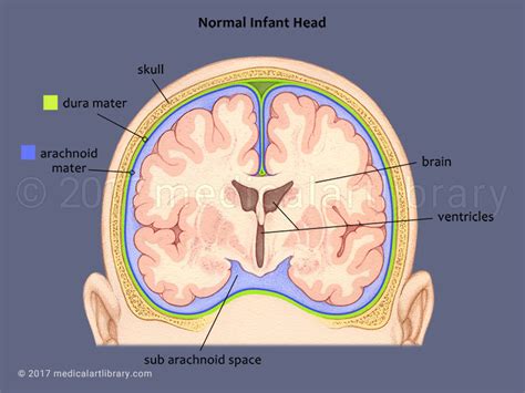 Infant Brain Coronal View Medical Art Library